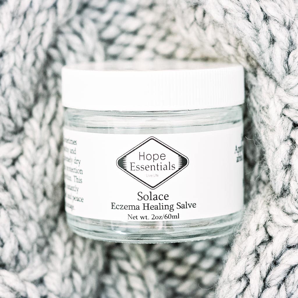 Solace - Eczema Healing Salve (Unscented) - My Hope Essentials